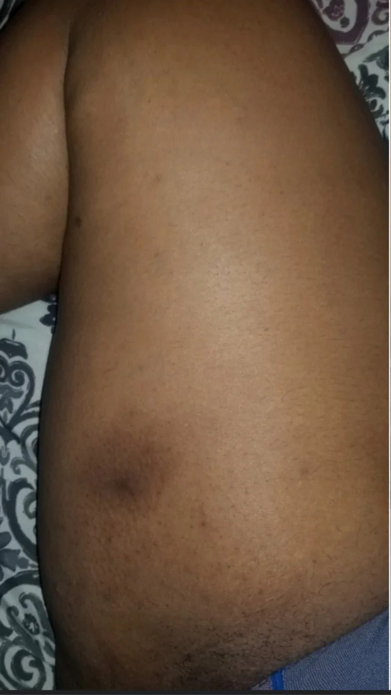 Turmeric & Kojic Acid Soap – Mavrik Beauty