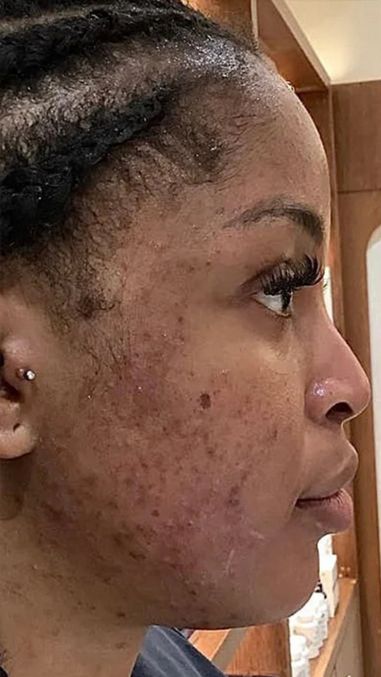 Turmeric & Kojic Acid Soap – Mavrik Beauty