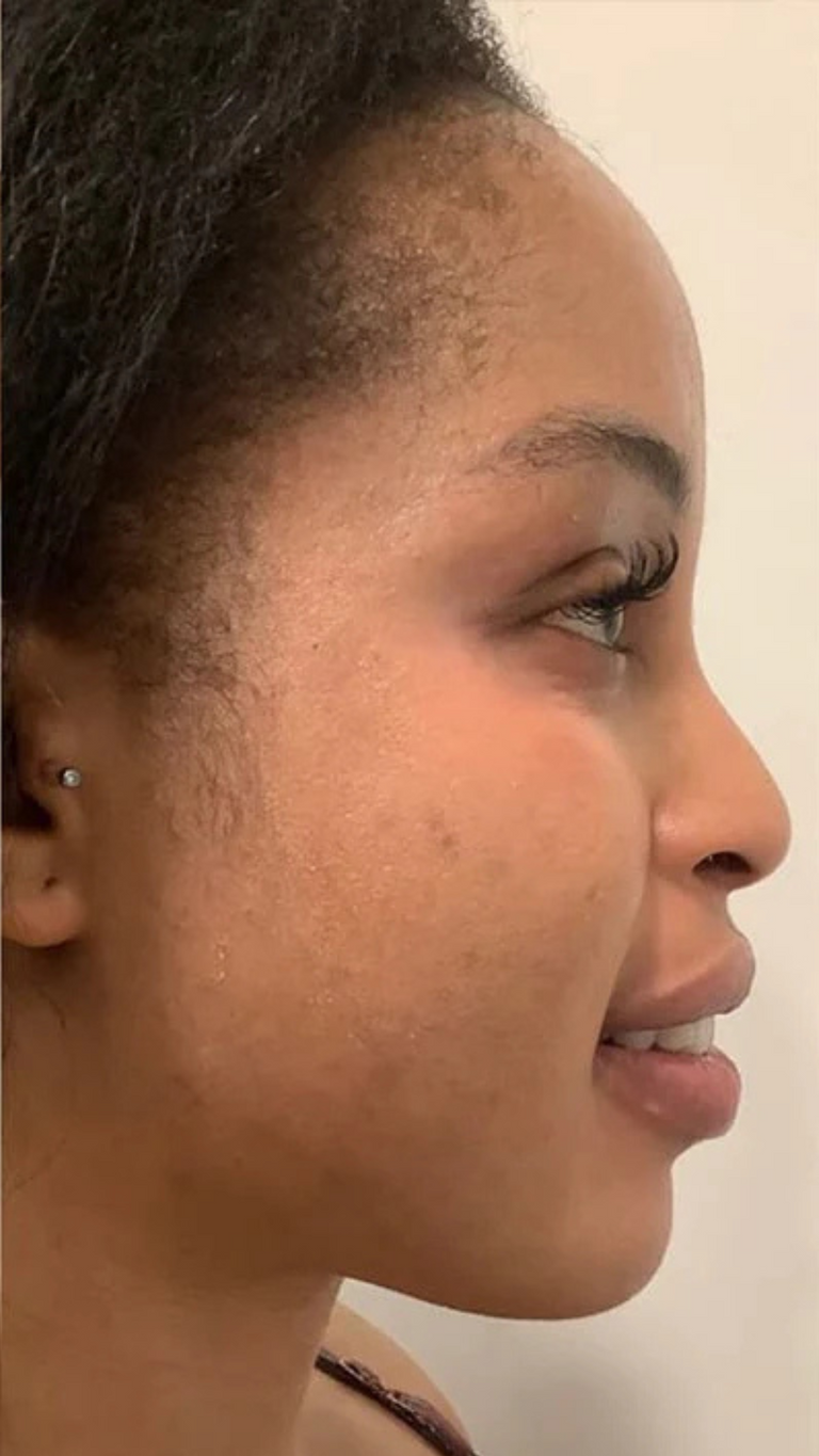 Turmeric & Kojic Acid Soap – Mavrik Beauty